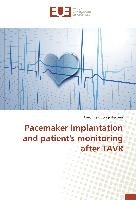 Pacemaker implantation and patient's monitoring after TAVR - Chong ...