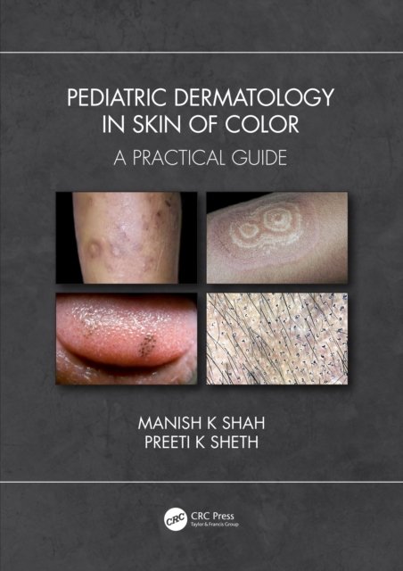 Pediatric Dermatology in Skin of Color: A Practical Guide - Opracowanie ...