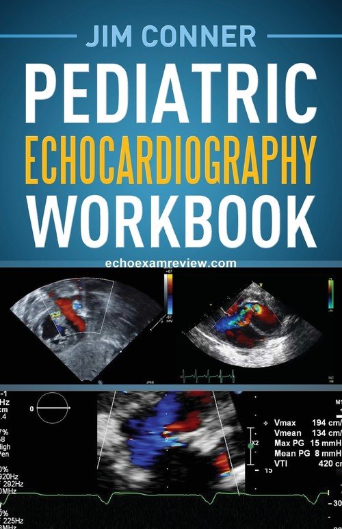 Pediatric Echocardiography Workbook - W opisie | Książka w Empik