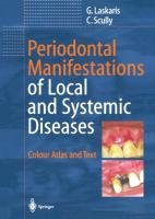 Periodontal Manifestations of Local and Systemic Diseases - Laskaris ...