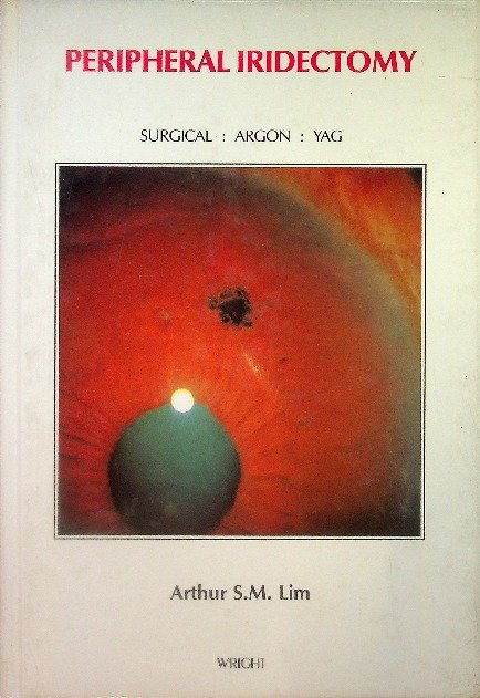 Peripheral Iridectomy - Opracowanie zbiorowe | Książka w Empik