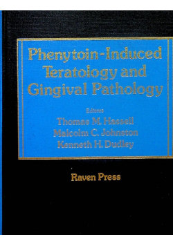 Phenytoin induced teratology and gingival pathology - Opracowanie ...