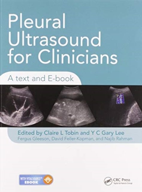 Pleural Ultrasound for Clinicians: A Text and E-book - Claire Tobin ...