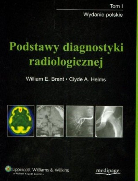 Podstawy diagnostyki radiologicznej Tom 1 - Clyde A. Helms | Książka w ...