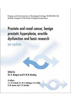 Prostate and renal cancer benign prostatic hyperplasia - | Książka w Empik