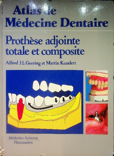 Prothèse adjointe totale et composite - Opracowanie zbiorowe | Książka w Empik