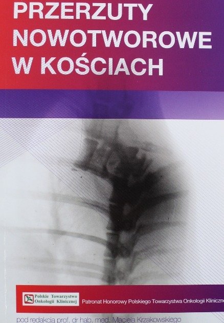 Przerzuty nowotworowe w kościach - W opisie | Książka w Empik