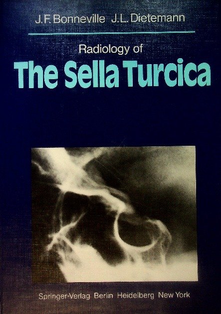 Radiology of the sella turcica - Opracowanie zbiorowe | Książka w Empik
