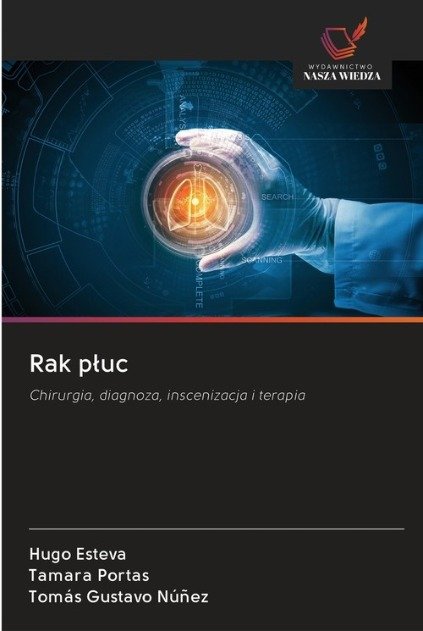 Rak płuc - Opracowanie zbiorowe | Książka w Empik
