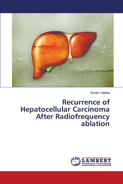 Recurrence of Hepatocellular Carcinoma After Radiofrequency ablation ...