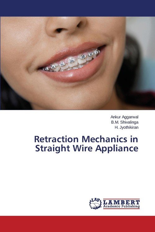 Retraction Mechanics in Straight Wire Appliance - Aggarwal Ankur ...