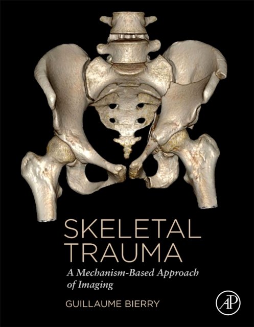 Skeletal Trauma: A Mechanism-Based Approach of Imaging - Opracowanie ...