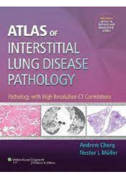 Systemic Vasculitides - Andrew Churg | Książka w Empik