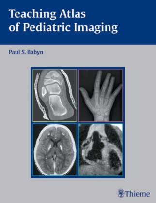 Teaching Atlas of Pediatric Imaging - Thieme, Stuttgart | Książka w Empik