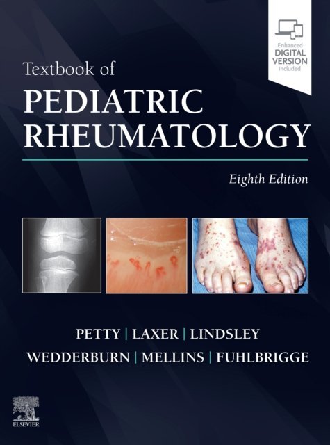 Textbook of Pediatric Rheumatology E-Book [DRM] - ebook PDF ...