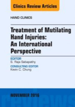 Treatment of Mutilating Hand Injuries An International Perspective ...