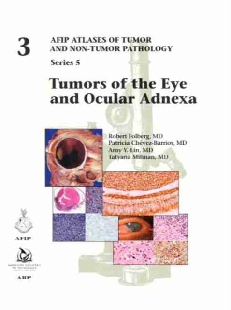 Tumors of the Eye and Ocular Adnexa - Opracowanie zbiorowe | Książka w ...