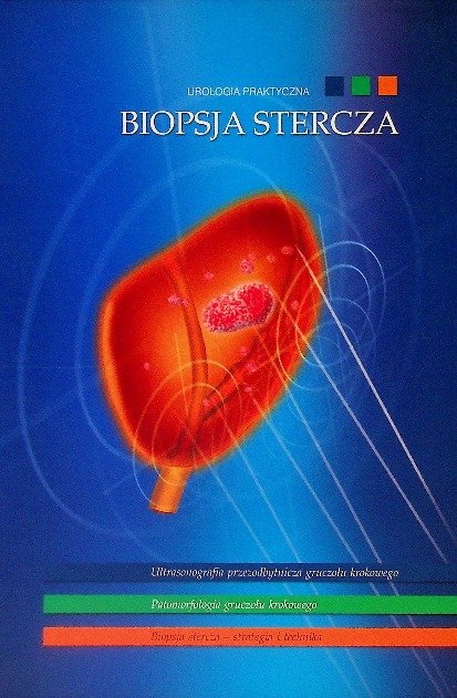 Urologia praktyczna biopsja stercza - Opracowanie zbiorowe | Książka w ...