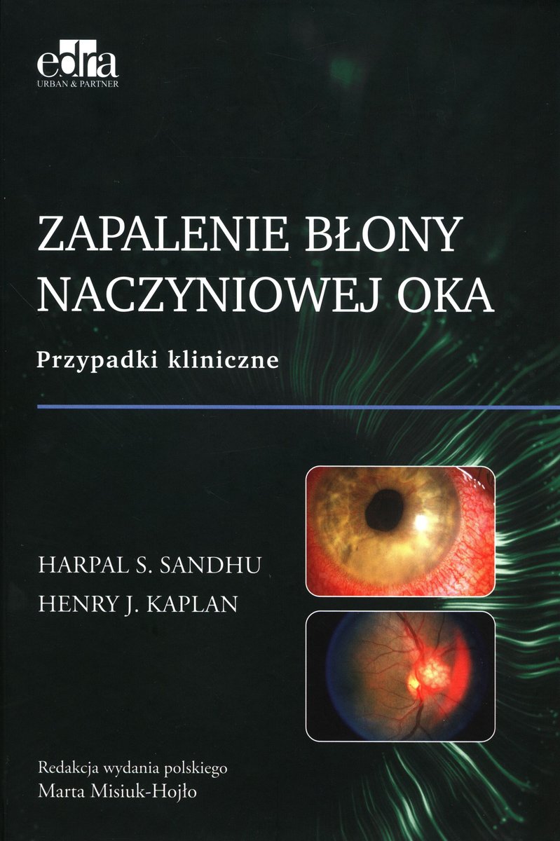 Zapalenie błony naczyniowej oka - H.S. Sandhu | Książka w Empik