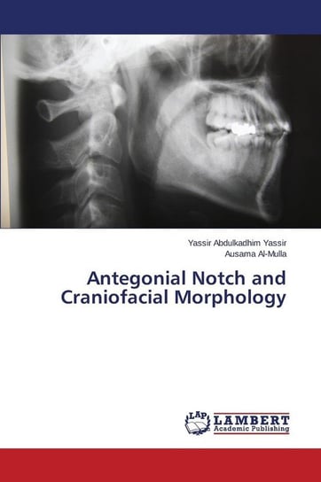 Antegonial Notch and Craniofacial Morphology - Abdulkadhim Yassir ...