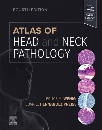 Atlas Of Head And Neck Pathology - Wenig Bruce M. | Książka w Empik