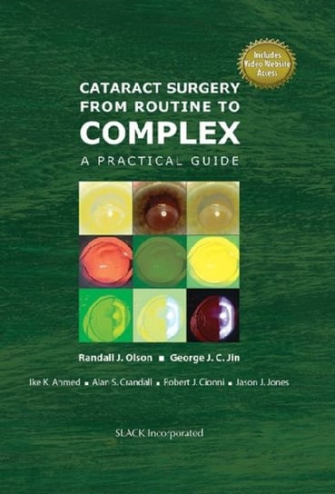 Cataract Surgery from Routine to Complex: A Practical Guide ...