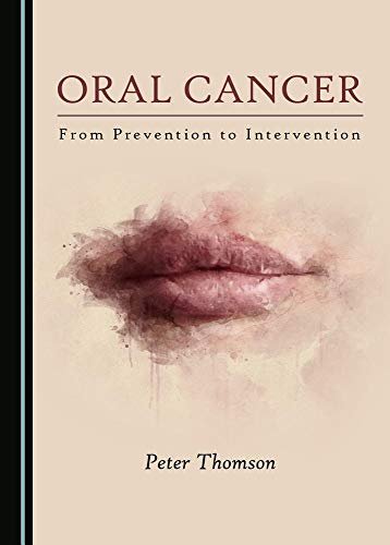 Oral Cancer. From Prevention to Intervention - Peter Thomson | Książka ...