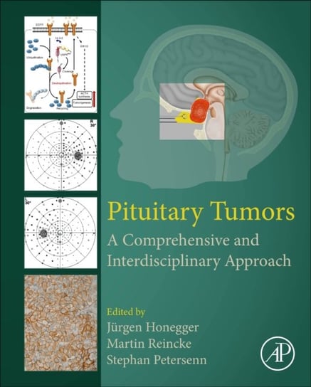 Pituitary Tumors. A Comprehensive and Interdisciplinary Approach ... Pituitary Tumors. A Comprehensive and Interdisciplinary Approach ...