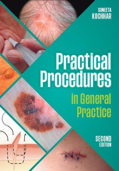 Practical Procedures in General Practice, second edition - Opracowanie zbiorowe | Książka w Empik