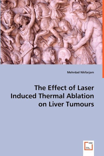 The Effect of Laser Induced Thermal Ablation on Liver Tumours ...