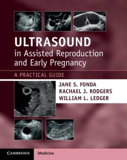 Ultrasound in Assisted Reproduction and Early Pregnancy. A Practical ...