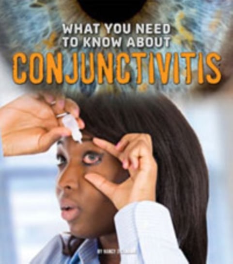 What You Need to Know about Conjunctivitis - Nancy Dickmann | Książka w ...